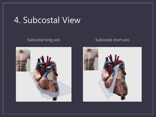Ultrasound in cardiac arrest | PPTX