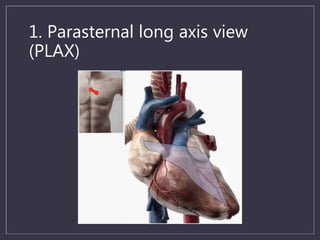Ultrasound in cardiac arrest | PPTX