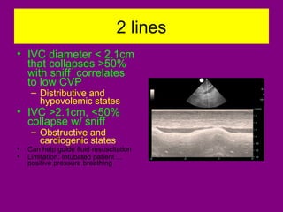 Ultrasound in critically ill patients | PPT