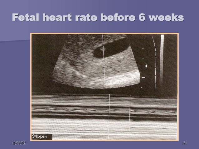 ULTRASOUND IN FIRST TRIMESTER.ppt | Pregnancy | Reproductive Health