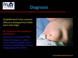 Ultrasound in hypertropic pyloric stenosis | PDF | Pregnancy ...