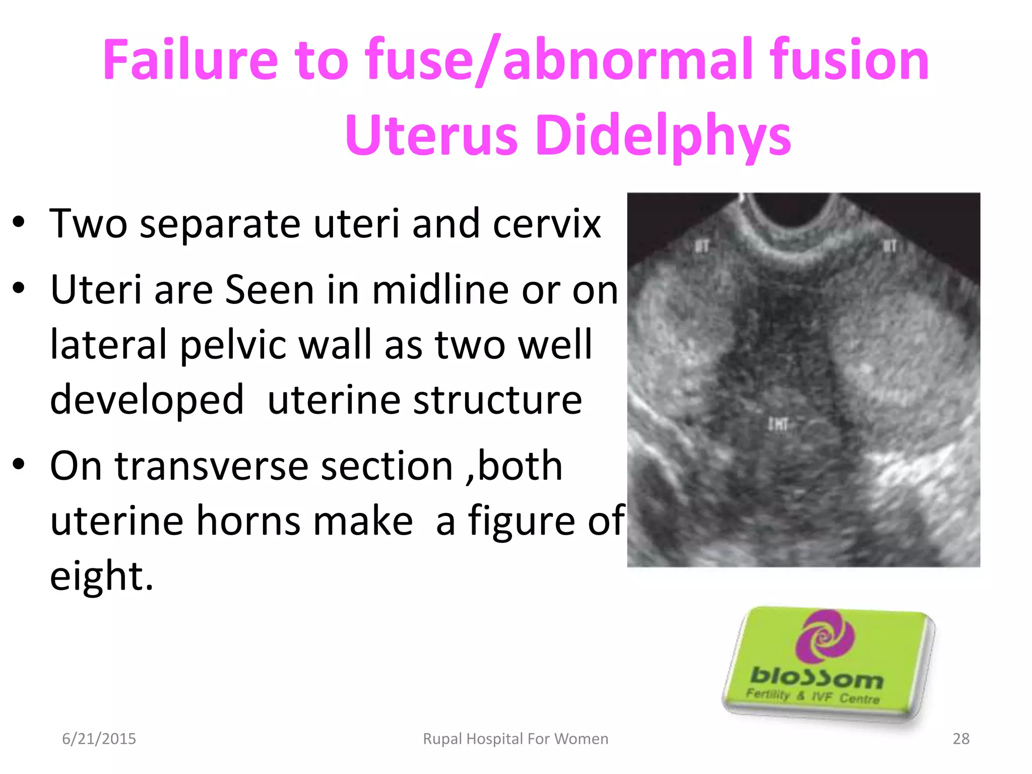 Ultrasound in infertility | PPTX