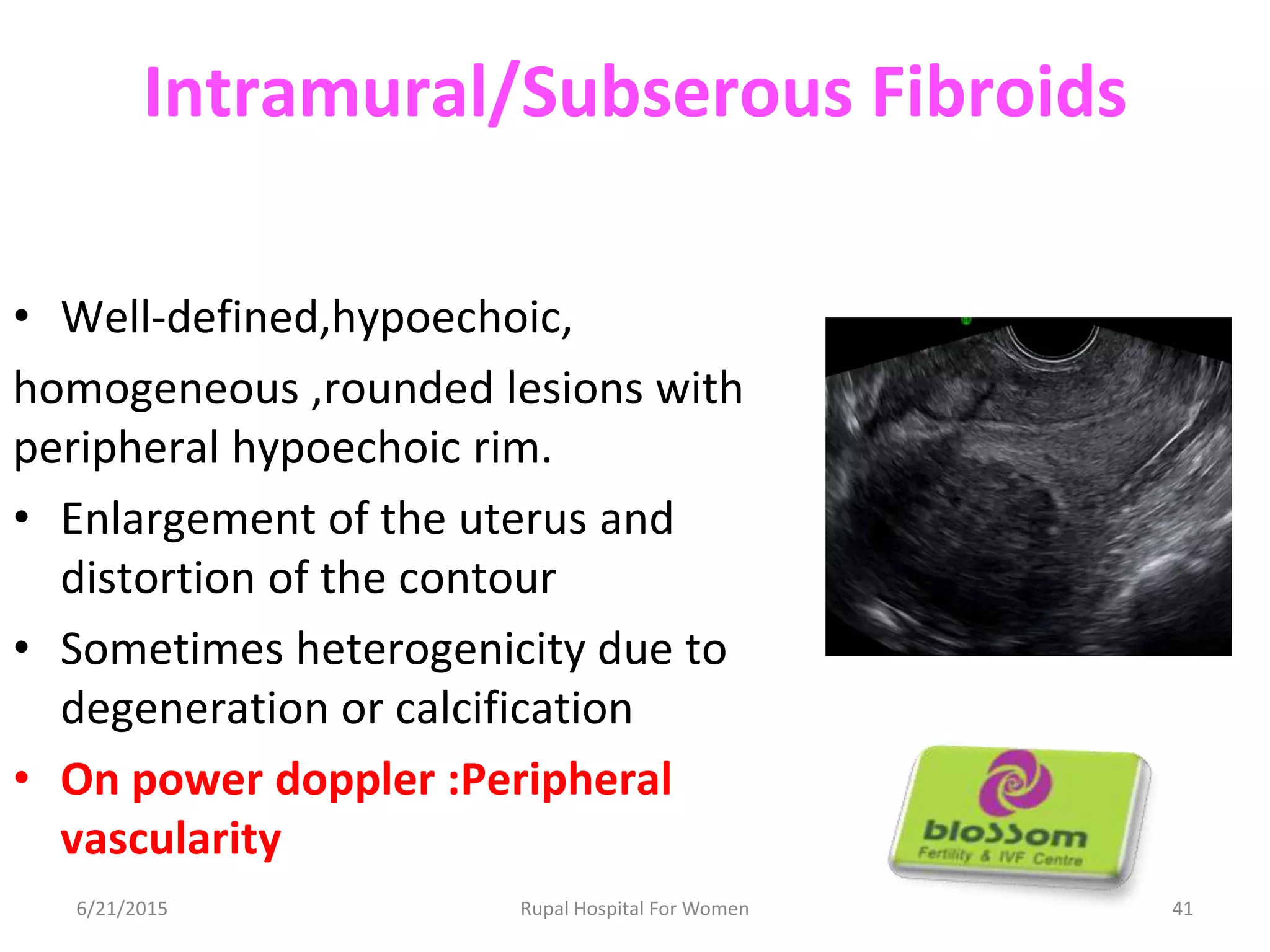 Ultrasound in infertility | PPTX