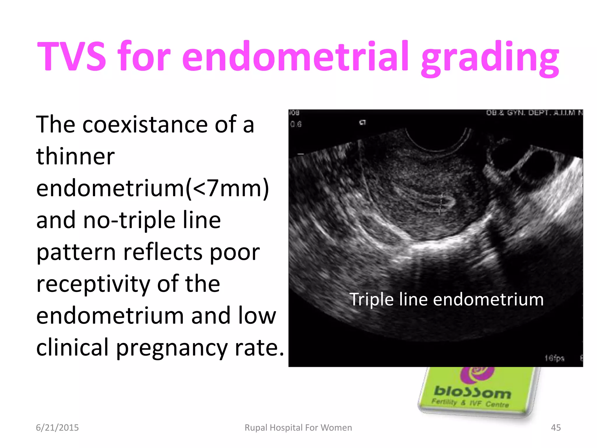 Ultrasound in infertility | PPTX