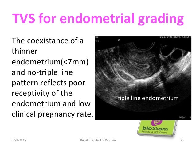 Endometrial Stripe Lining