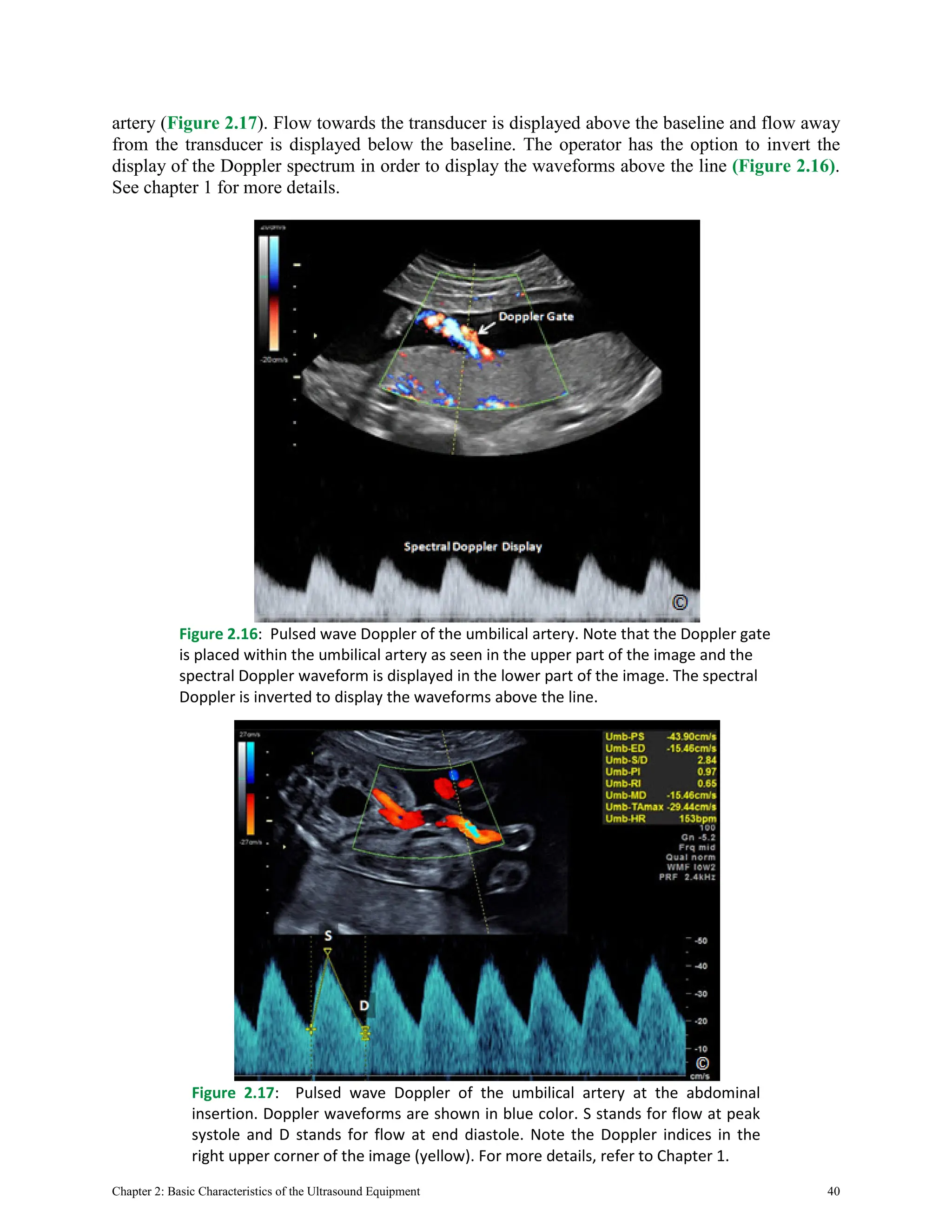 Ultrasound_in_obstetrics_and_gynecology.pdf