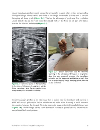 Ultrasound_in_obstetrics_and_gynecology.pdf