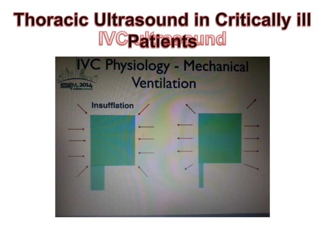 Ultrasound in ricu | PPT