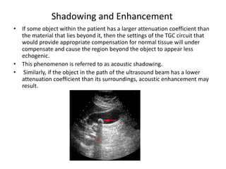 Ultrasound instrumentation | PPTX