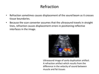 Ultrasound instrumentation | PPTX