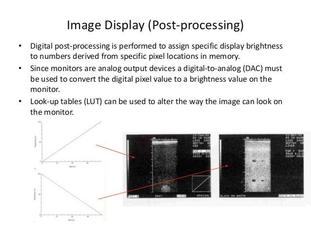 Ultrasound instrumentation