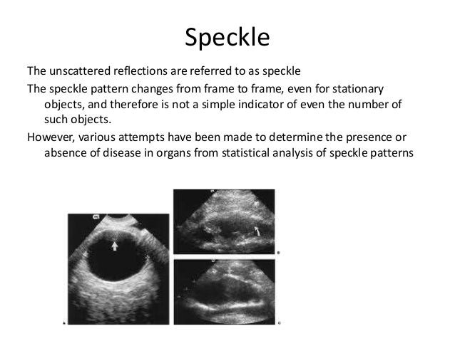 Ultrasound instrumentation