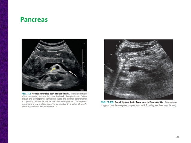 ULTRASOUND,_ITS_ADVANCEMENTS_IN_CLINICAL_APPLICATION_AND_by_joginder (1).pptx | Digital Audio ...