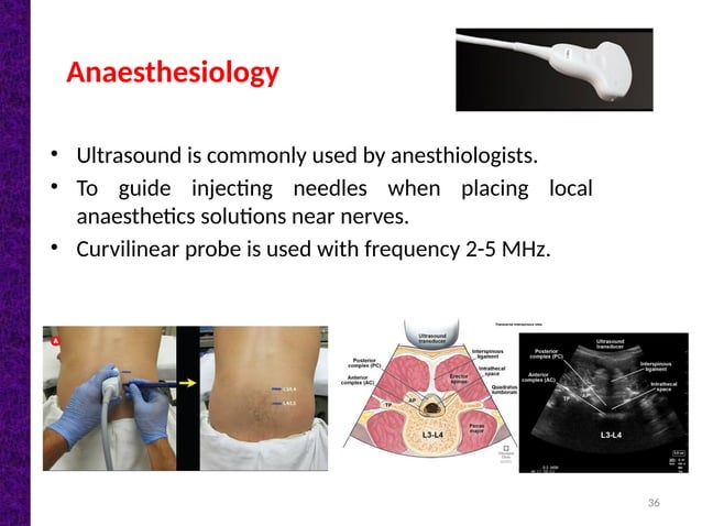ULTRASOUND,_ITS_ADVANCEMENTS_IN_CLINICAL_APPLICATION_AND_by_joginder (1).pptx | Digital Audio ...