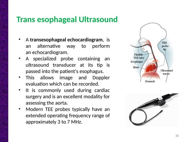 ULTRASOUND,_ITS_ADVANCEMENTS_IN_CLINICAL_APPLICATION_AND_by_joginder (1).pptx | Digital Audio ...