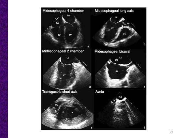 ULTRASOUND,_ITS_ADVANCEMENTS_IN_CLINICAL_APPLICATION_AND_by_joginder (1).pptx | Digital Audio ...