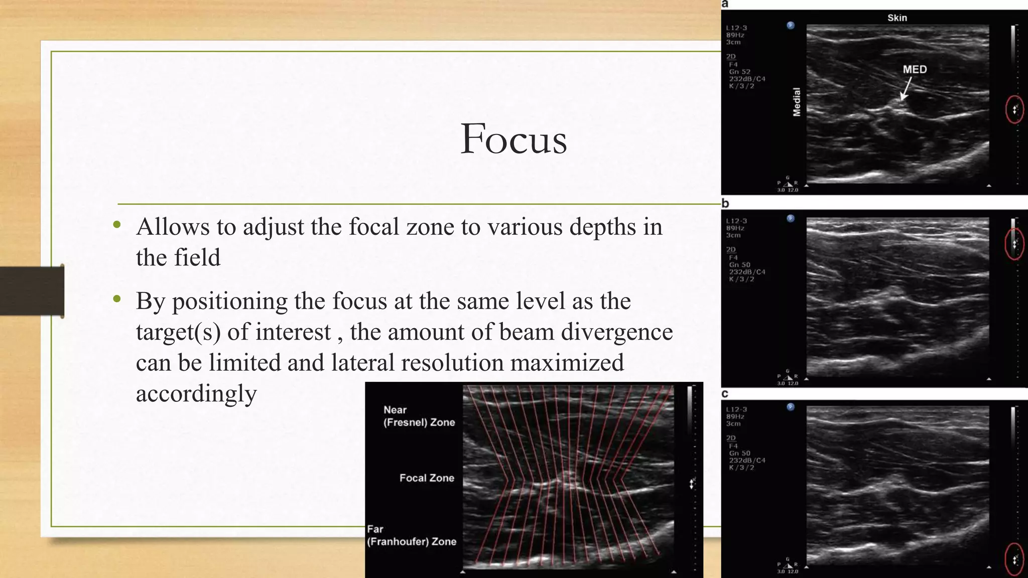Ultrasound knobology | PPTX