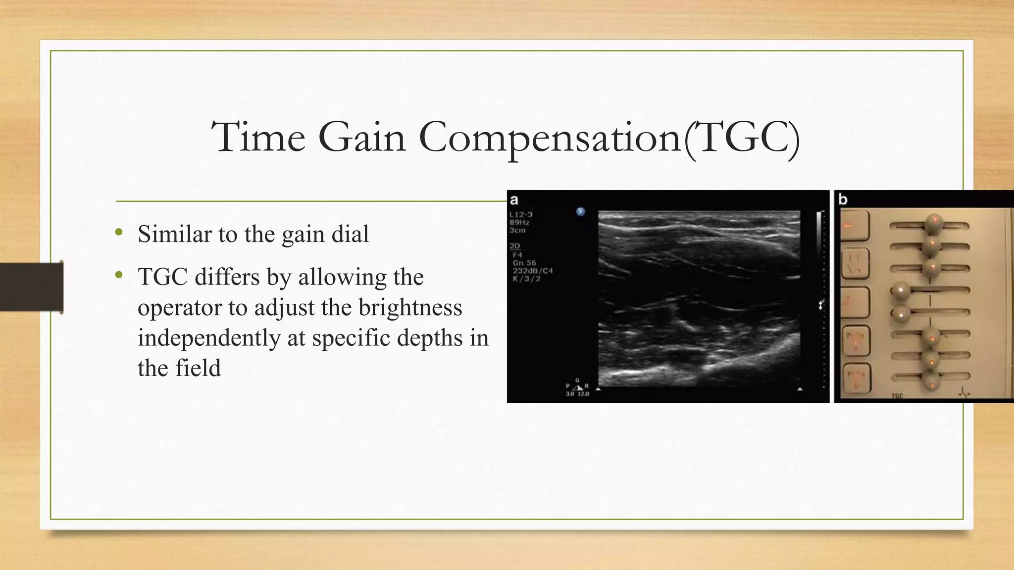 Ultrasound knobology | PPTX