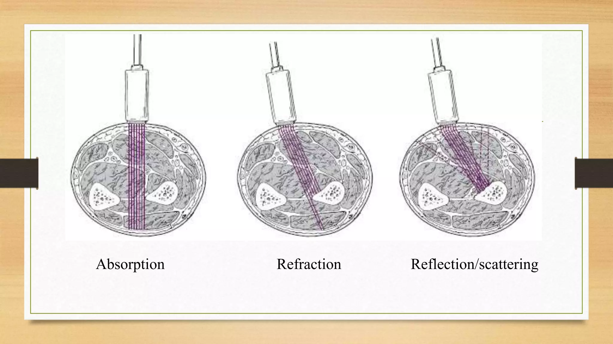 Ultrasound knobology | PPTX