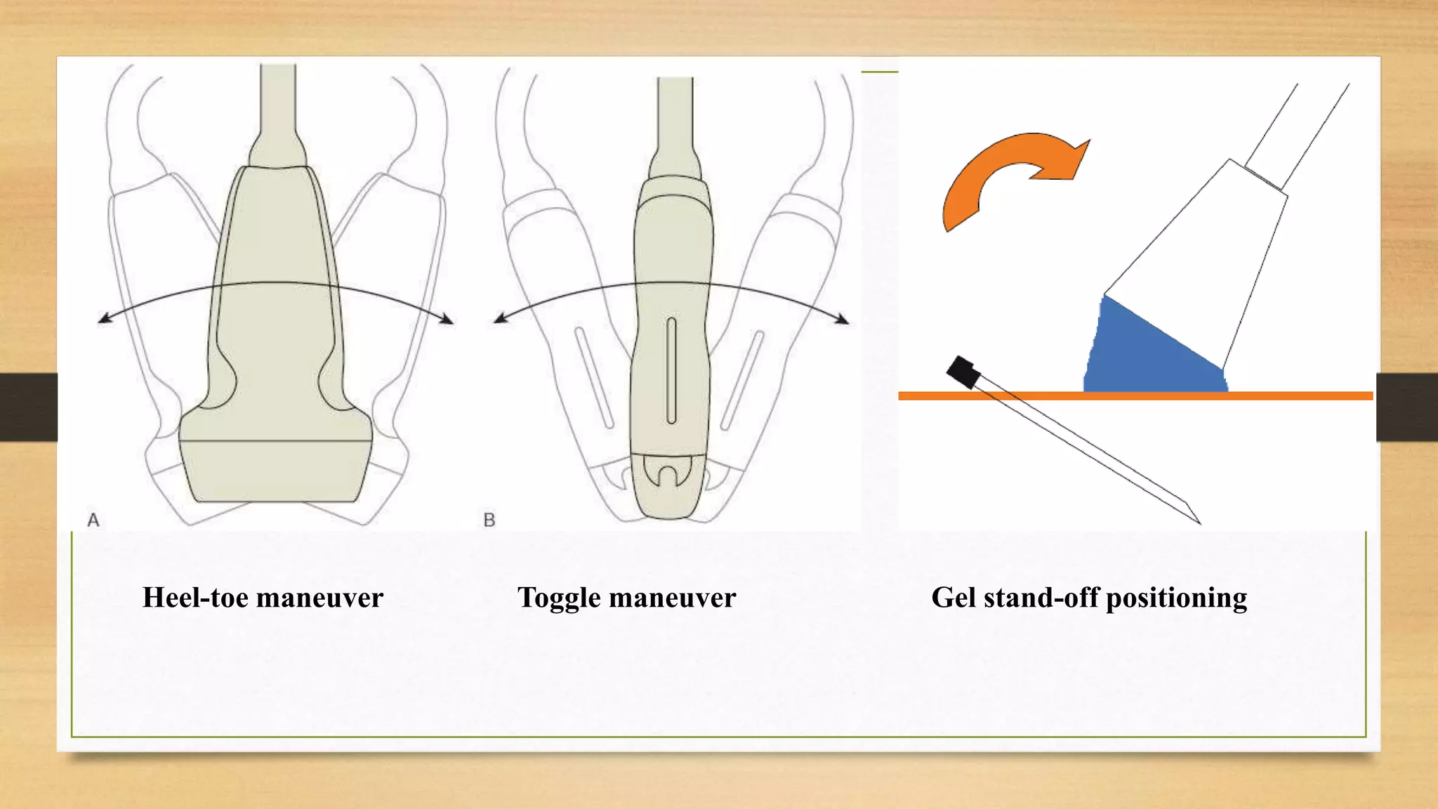 Ultrasound knobology | PPTX