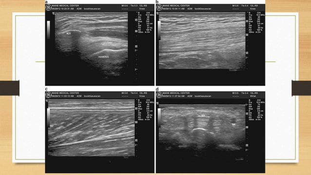 Ultrasound knobology | PPTX | Digital Audio | Computer Software and ...