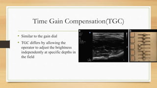 Ultrasound knobology | PPTX