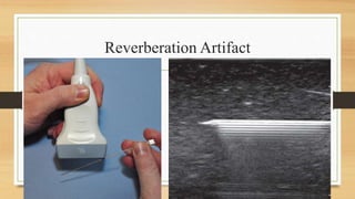 Ultrasound knobology | PPTX
