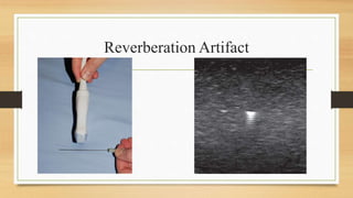 Ultrasound knobology | PPTX