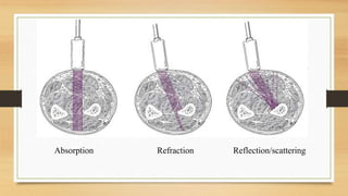 Ultrasound knobology | PPTX