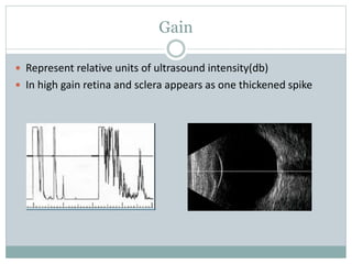 Ultrasound in Ophthalmology.pptx