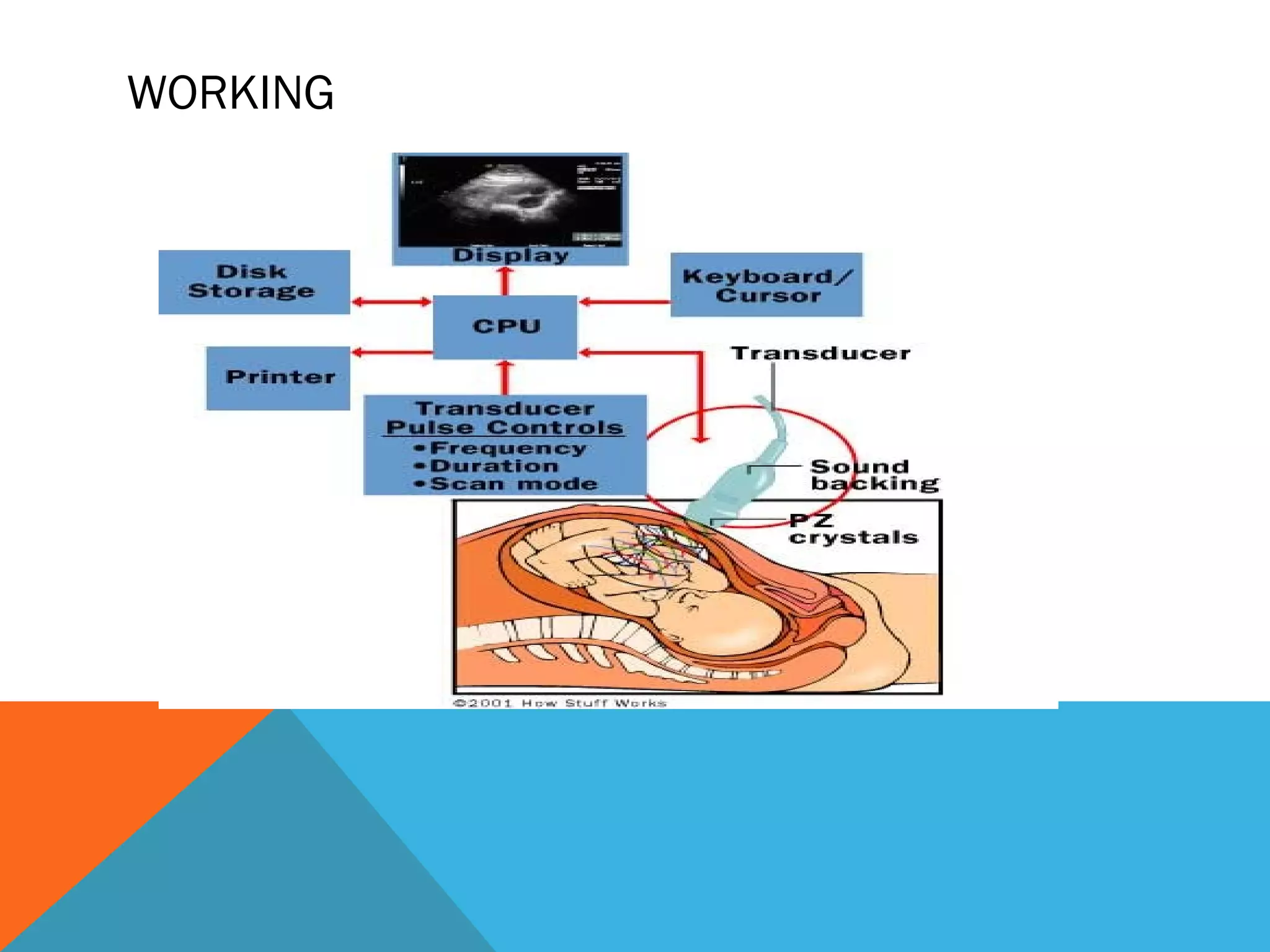 Ultrasound machine | PPT