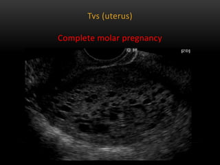 ULTRASOUND my edit.ppt