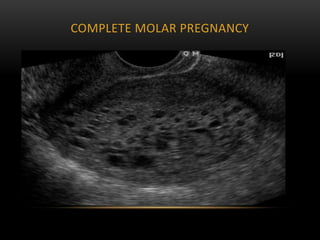 ULTRASOUND my edit.ppt