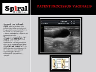 Ultrasound november 17 | PPTX | Pregnancy | Reproductive Health
