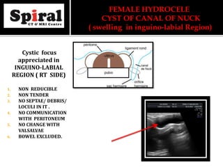 Ultrasound november 17 | PPTX | Pregnancy | Reproductive Health