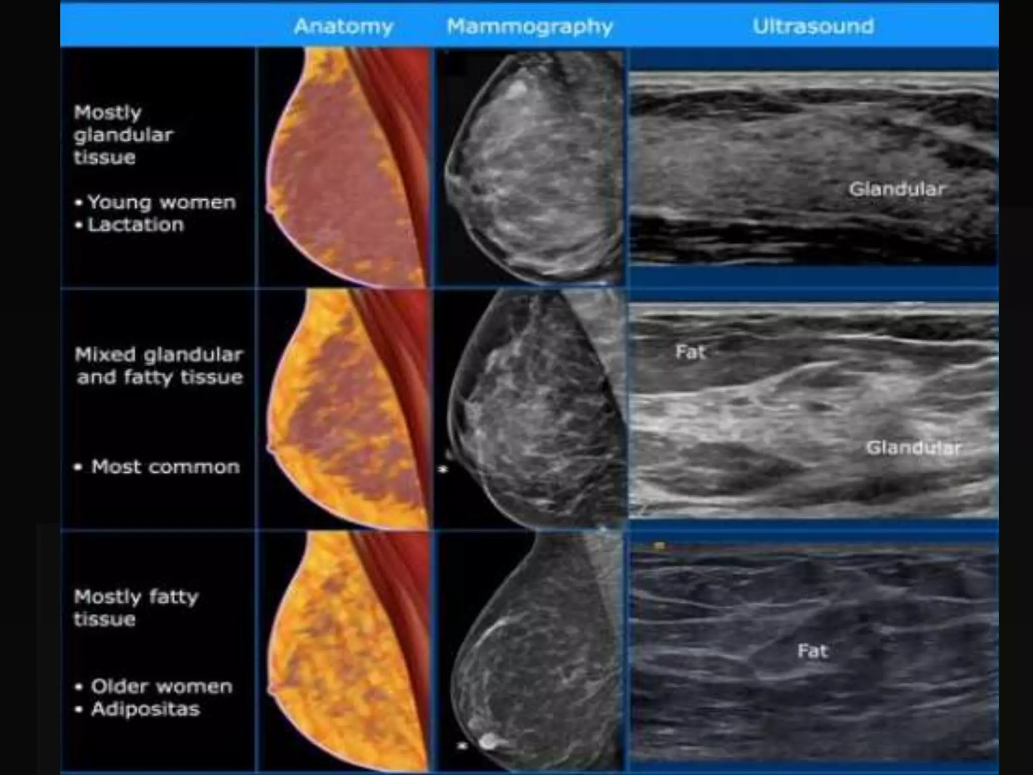 Ultrasound of breast | PPTX
