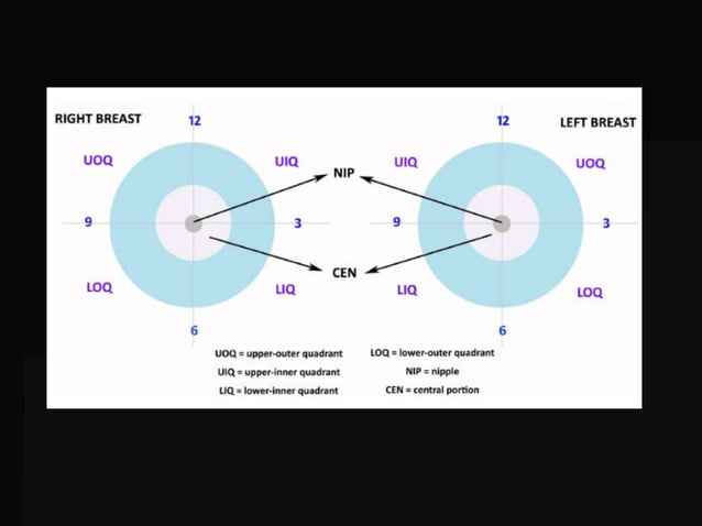 Ultrasound of breast | PPTX