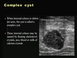Ultrasound of breast | PPTX
