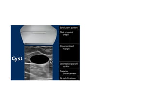 ULTRASOUND OF BREAST by radiology assistant | PPTX