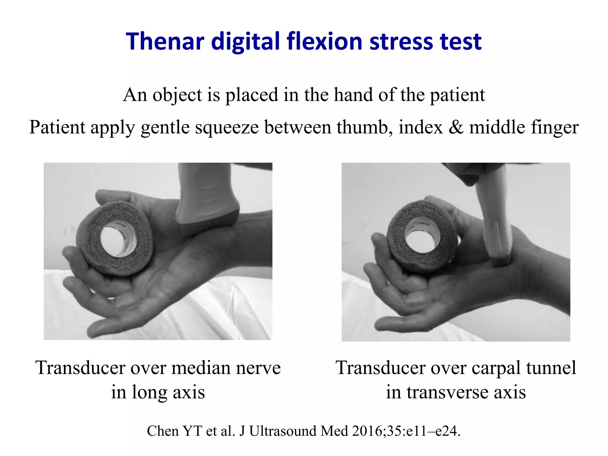 Ultrasound of carpal tunnel syndrome | PPTX