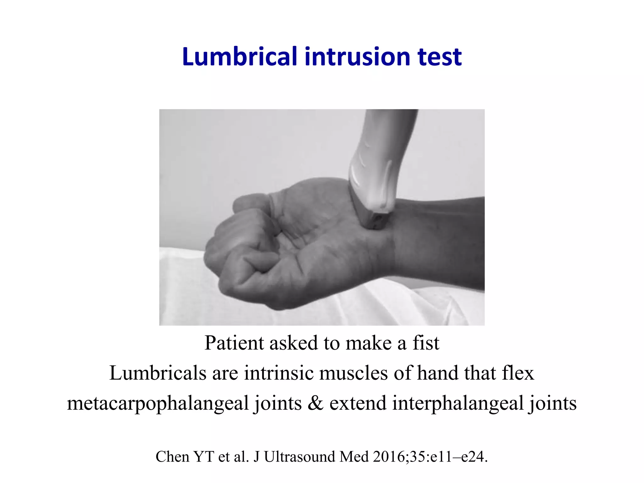 Ultrasound of carpal tunnel syndrome | PPTX