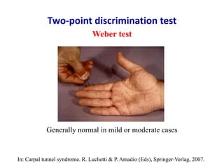 Ultrasound of carpal tunnel syndrome | PPTX