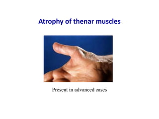 Ultrasound of carpal tunnel syndrome | PPTX