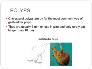Ultrasound of gall bladder | PPTX