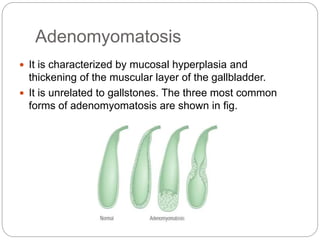 Ultrasound of gall bladder | PPTX