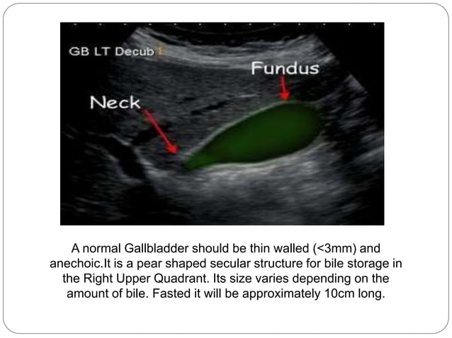 Ultrasound of gall bladder | PPTX