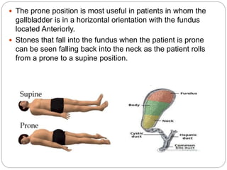 Ultrasound of gall bladder | PPTX