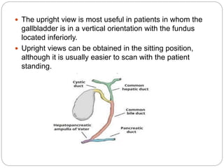 Ultrasound of gall bladder | PPTX