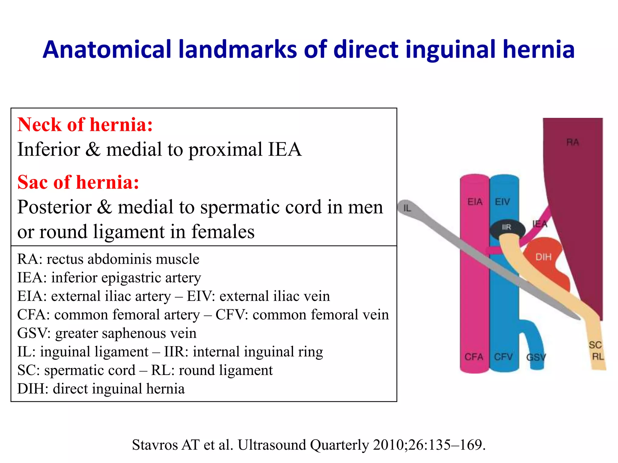 Ultrasound of groin & anterior abdominal wall hernias | PPTX