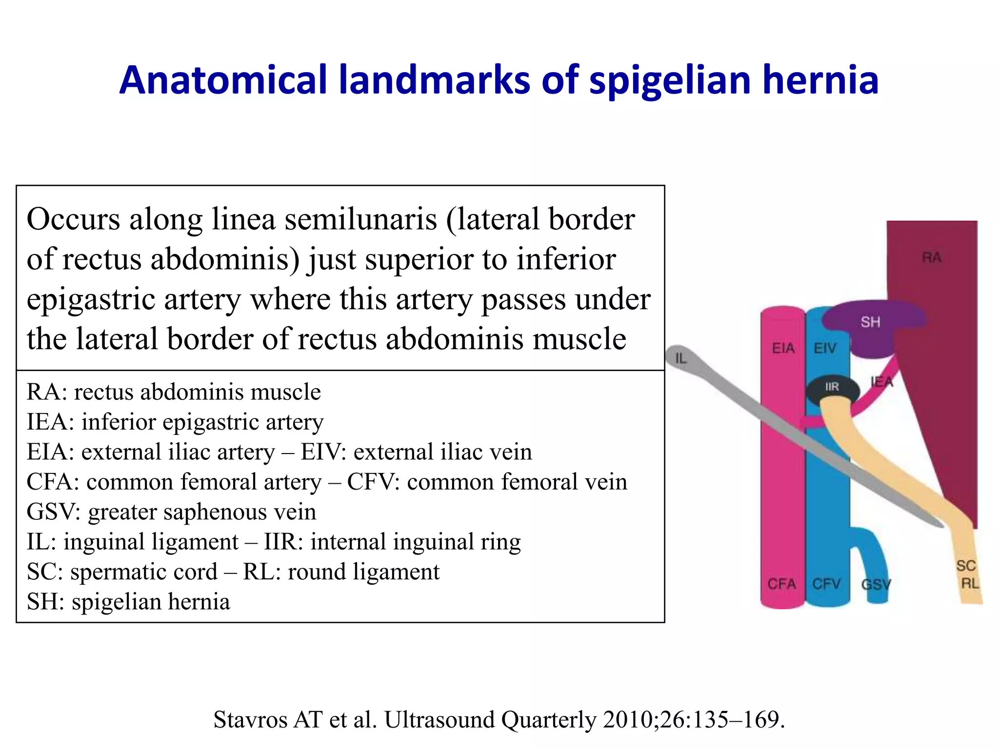 Ultrasound of groin & anterior abdominal wall hernias | PPTX